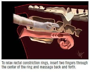Artificially inseminate in cattle | Engormix