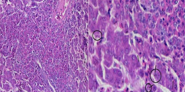 Role of histopathological examination in diagnosis of avian leucosis ...