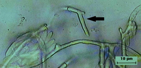 Identification and Production of Beauvericin by Fusarium ...