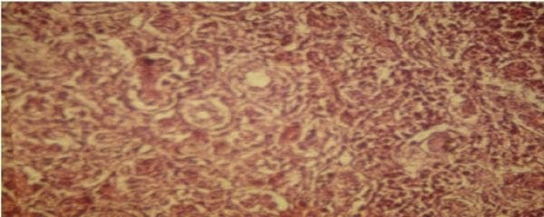 Salpingitis in poultry | Engormix